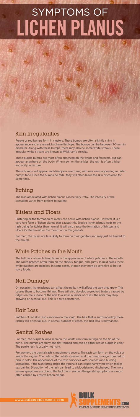 Lichen Planus Its Time For Relief Treatment For Rashes And Dental Pain