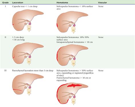 Imaging Evaluation Of Trauma Radiology Key