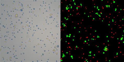 Automated Cell Counter Unicorn Lifescience