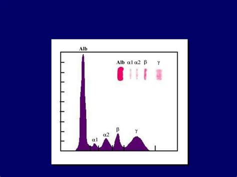 Ppt Multiple Myeloma Pathogenesis And Clinical Presentation Powerpoint Presentation Id 6110586