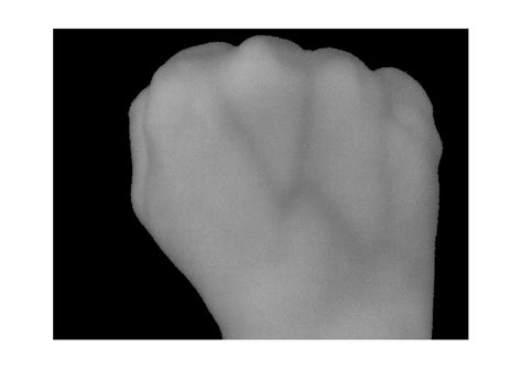 Matlab How To Eleiminate The Black Background And Retain The Region Of Interest In My Image
