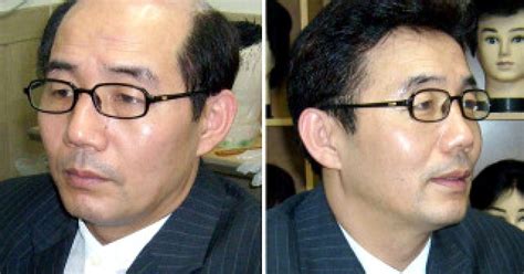 셀모 첨단 헤어웨어 심는 가발 할인이벤트