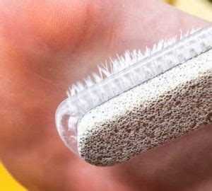 Homemade Remedy To Get Rid Of Calluses Fast DIY Joy