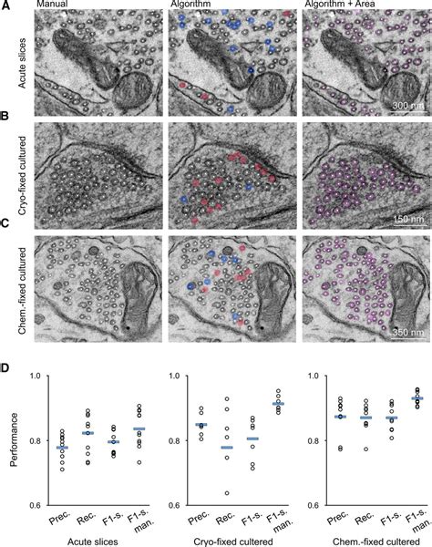 Neuron Synapse Microscope