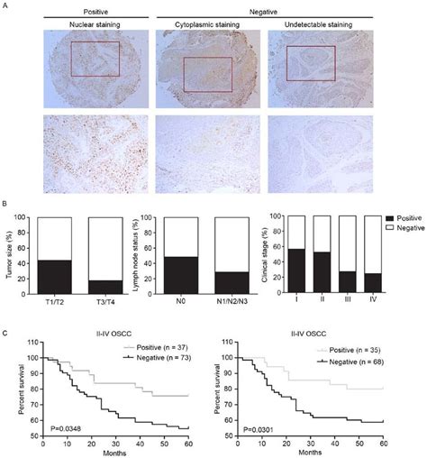 negative expression of runx3 is associated with tumor size lymph node