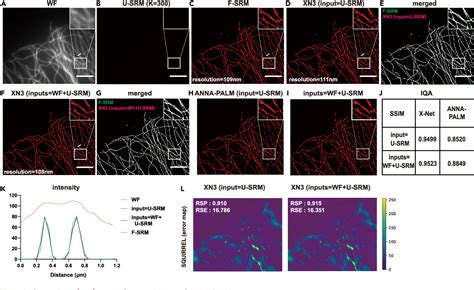 Figure 2 From Deep Learning Enables Stochastic Optical Reconstruction