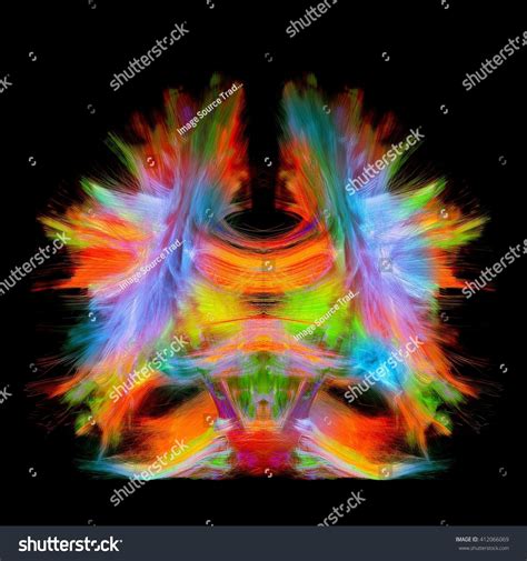 Brain Tractography Over 27 Royalty Free Licensable Stock Illustrations And Drawings Shutterstock