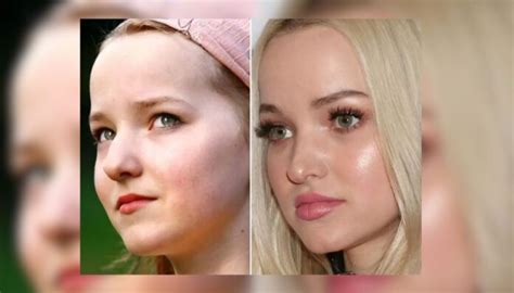 Dove Cameron Archives Amy