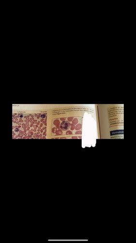 Exam 3 Flashcards Quizlet
