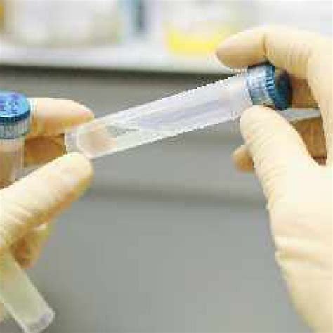 Hiv Ireland And Hse Team Up To Offer Free Syphillis Testing Kfm