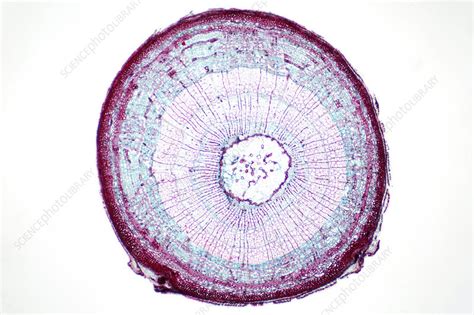 Plant Stem Light Micrograph Stock Image F Science Photo Library
