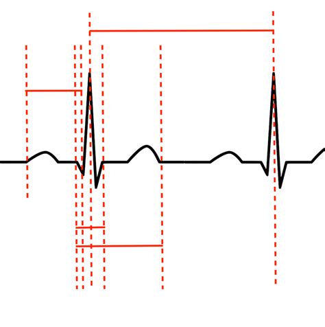 Practical 1 Lab 3 Ekg Diagram Quizlet