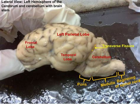 Brain Dissection Pictures Pptx