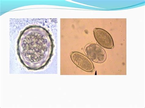 Pemeriksaan Faeses Ppt