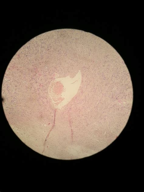 What Is The Differential Diagnosis Of This Right Auricular Swelling