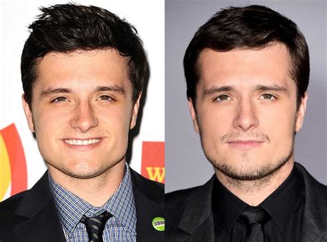 Celebrity Nose Jobs 20 Celebrities That Have Had Rhinoplasty With