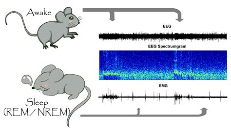 GitHub Li Shen Amy Eeg Sleep MATLAB Code For Sleep Cycle Analysis From EEG Signals