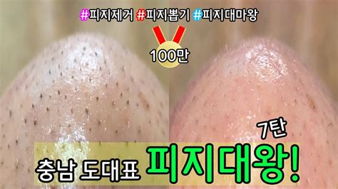피지 직접 뽑아드렸습니다 피지제거 블랙헤드제거 피지뽑기 충남 도대표 남자구독자님 피지제거 현장속으로 빠져봅시다 기대만빵 7탄 시작합니다 Youtube