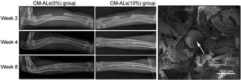 Comparison Of CS ALs Implanted Group To CS ALs Found Download Scientific Diagram