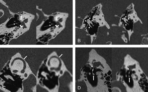 Otology And Neurotology