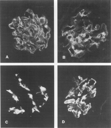 A Immunofluorescence Photomicrograph Of Glomerulus From A Mouse Given