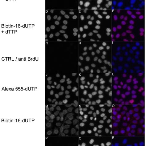 The Detection Of The Mitochondrial Genome The Detection Of The Download Scientific Diagram