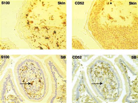 Expression Of Cd52 By Tissue Dendritic Cells Staining Of Adjacent