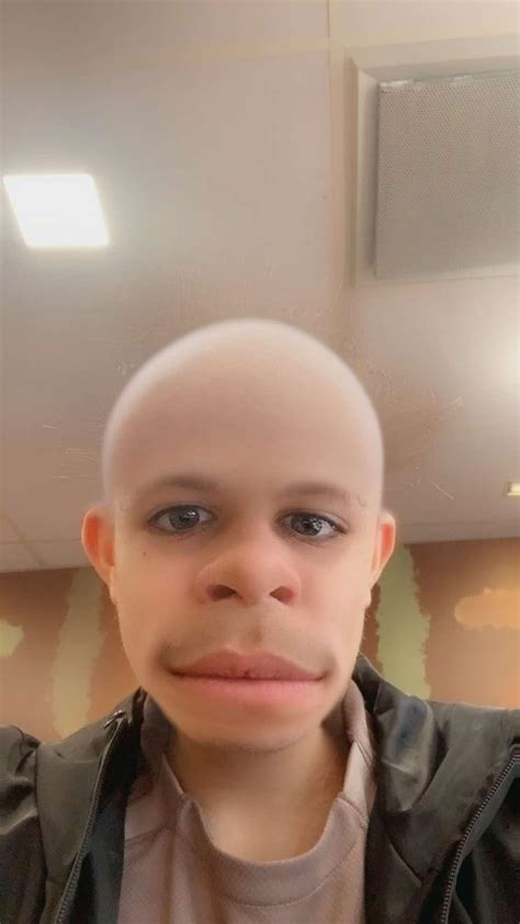 Am I Cute I Have Bdsm Scars Rboombeach