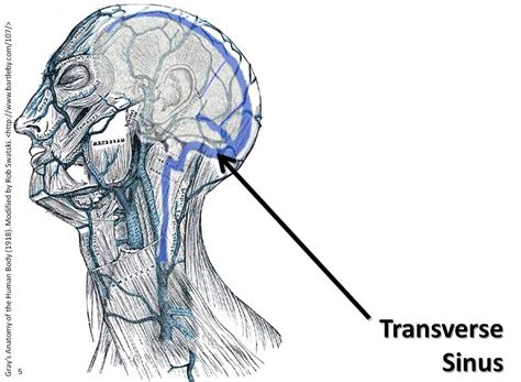 Transverse Sinus The Anatomy Of The Veins Visual Guide … Flickr