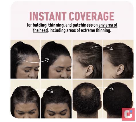 Boldify Review 2026 Effective Hair Thickening Pixoneye
