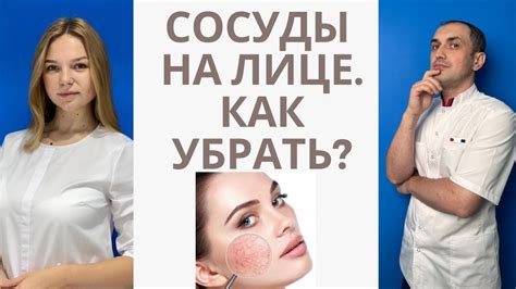 Как убрать сосуды на лице Флеболог Москва Youtube