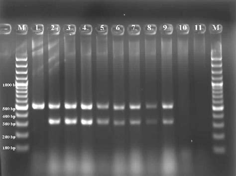 Salmonella Specific Genes Inva And S Enteritidis Specific Sefa Were Download Scientific