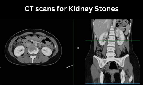 The Difference Between Ct Scan And X Ray Kiran Lab