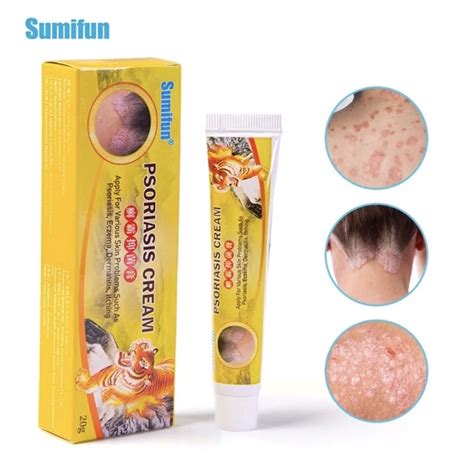 Eczema Psoriasis Dermatitis Ointment Herbal Antibacterial Anti Itch