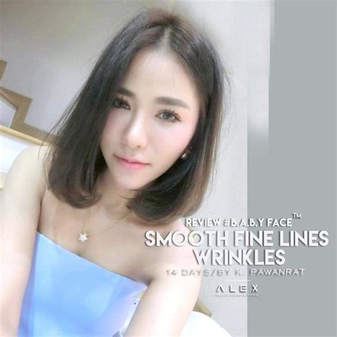 Pin By Dralex Aesthetic Clinic On Thailand Plastic Surgery Wrinkles