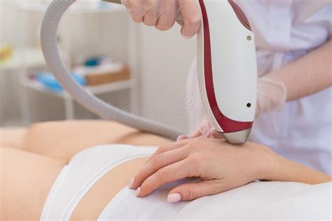 Woman On Laser Epilation Procedure Hardware Removal Of Unwanted Vegetation On Hands Stock Photo