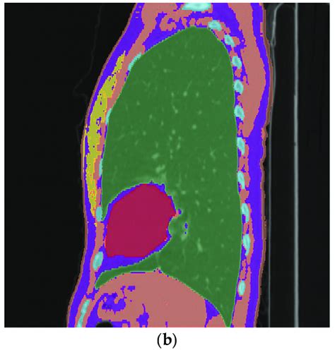 An Example Within The Chest Ct Image Sequences Used To Create Voxelized Download Scientific
