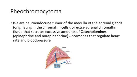 Adrenal Gland Diseasescushing Syndromeaddison Disease And