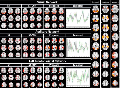 论文精读 Characterizing Functional Brain Networks Via Spatio Temporal