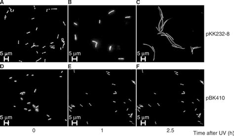 Fluorescence Microscopy Of Uv Exposed 50 Jm2 Cells Carrying The Download Scientific Diagram