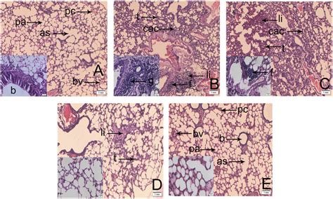 A Histological Appearance Of Lung Tissue Of Normal Control Showing