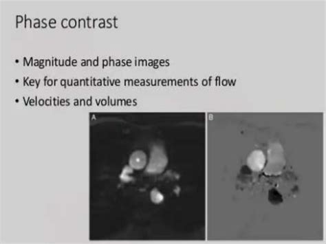 Cardiac Mri Basics Pptx