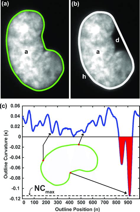 Quantifying Nuclear Shape Characteristics A Nucleus Outline Generated