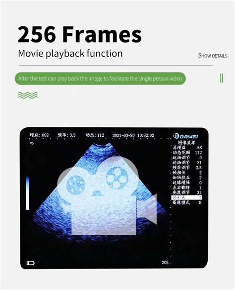 Laptop Portable Wireless Ultrasound Machine Convex Linear Micro Convex Rectal Probe Afrimart