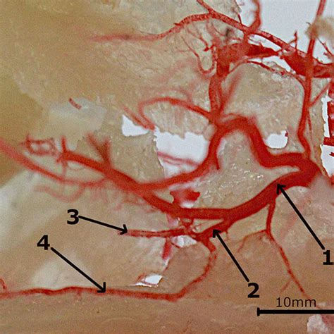 Some Terminal Branches Of The Maxillary Artery Corrosion Cast 1 The Download Scientific