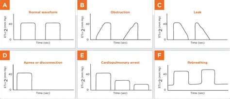 Capnography Assessing Ventilation During Anesthesia Todays Veterinary Practice