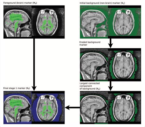 Figure 3 From Brain Extraction Using The Watershed Transform From Markers Semantic Scholar