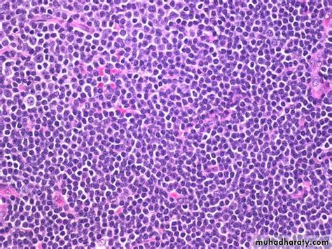Lymph Node Pptx D Hameed Muhadharaty