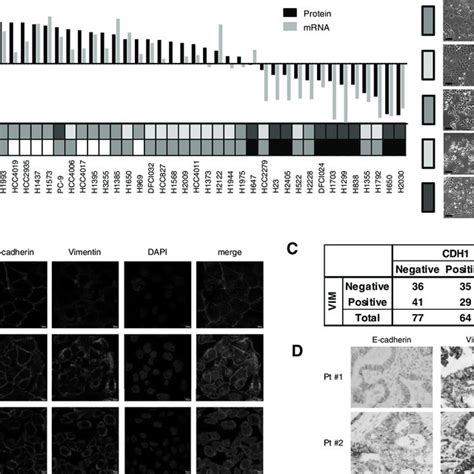 Classification Of NSCLC Cell Lines A Log2 Transformed Ratios Of