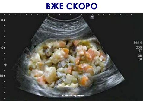 Вже скоро